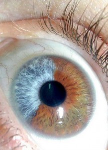 Seriously Messed Up Human Eyes | KLYKER.COM