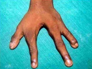 Bizarre-Looking Human Hands and Feet | KLYKER.COM