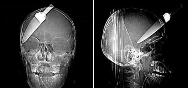 Unbelievably Bizarre X-Rays | KLYKER.COM