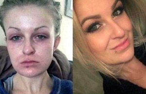 During And After Drug Consumption | KLYKER.COM