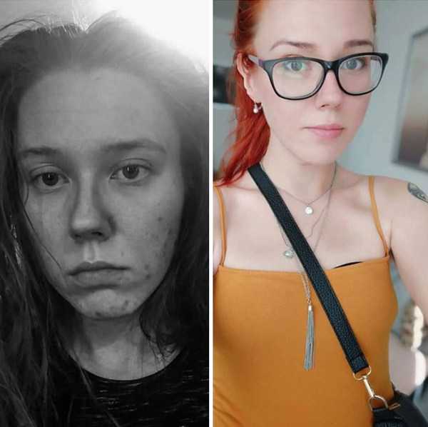 During And After Drug Consumption | KLYKER.COM
