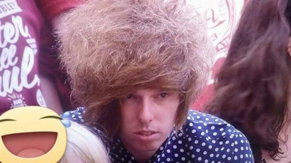 Circus Freaks of the Past (21 photos) | KLYKER.COM