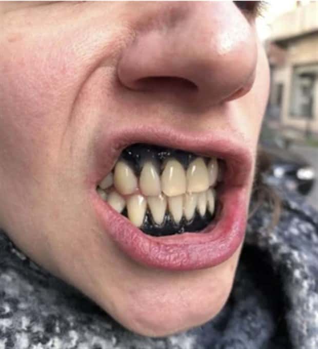 Crappy Tattoos that Shouldn’t Have Been Done #24 | KLYKER.COM