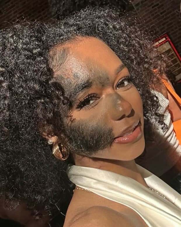 28 People Flaunting Their Cool Birthmarks | KLYKER.COM