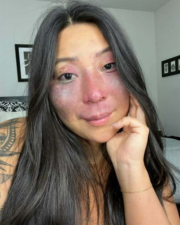 28 People Flaunting Their Cool Birthmarks | KLYKER.COM