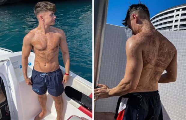 28 People Flaunting Their Cool Birthmarks | KLYKER.COM